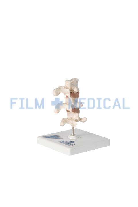 Anatomical Model of the Spine | FILM MEDICAL