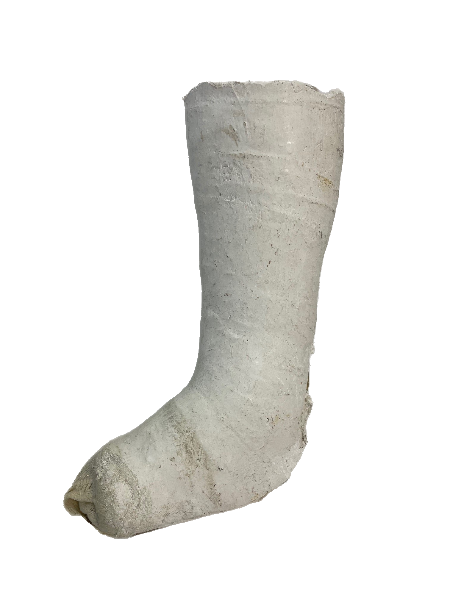 Plaster Half Leg Cast | FILM MEDICAL