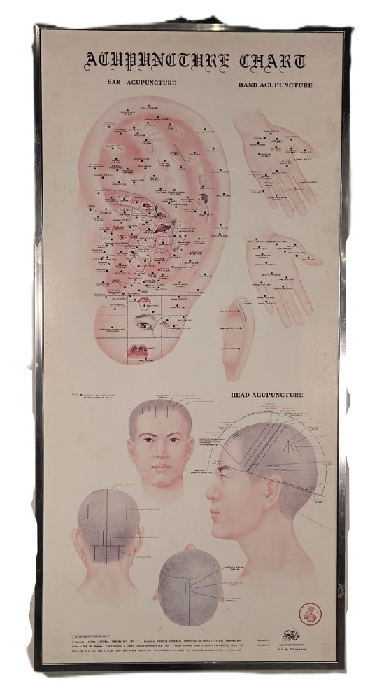 Acupuncture Chart | FILM MEDICAL