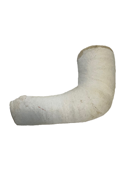 Plaster Arm Cast (Left) | FILM MEDICAL