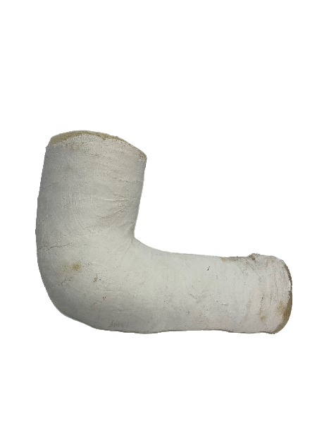 Plaster Arm Cast (Right) | FILM MEDICAL