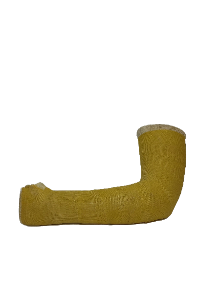 Fibreglass Arm Cast (Left) | FILM MEDICAL