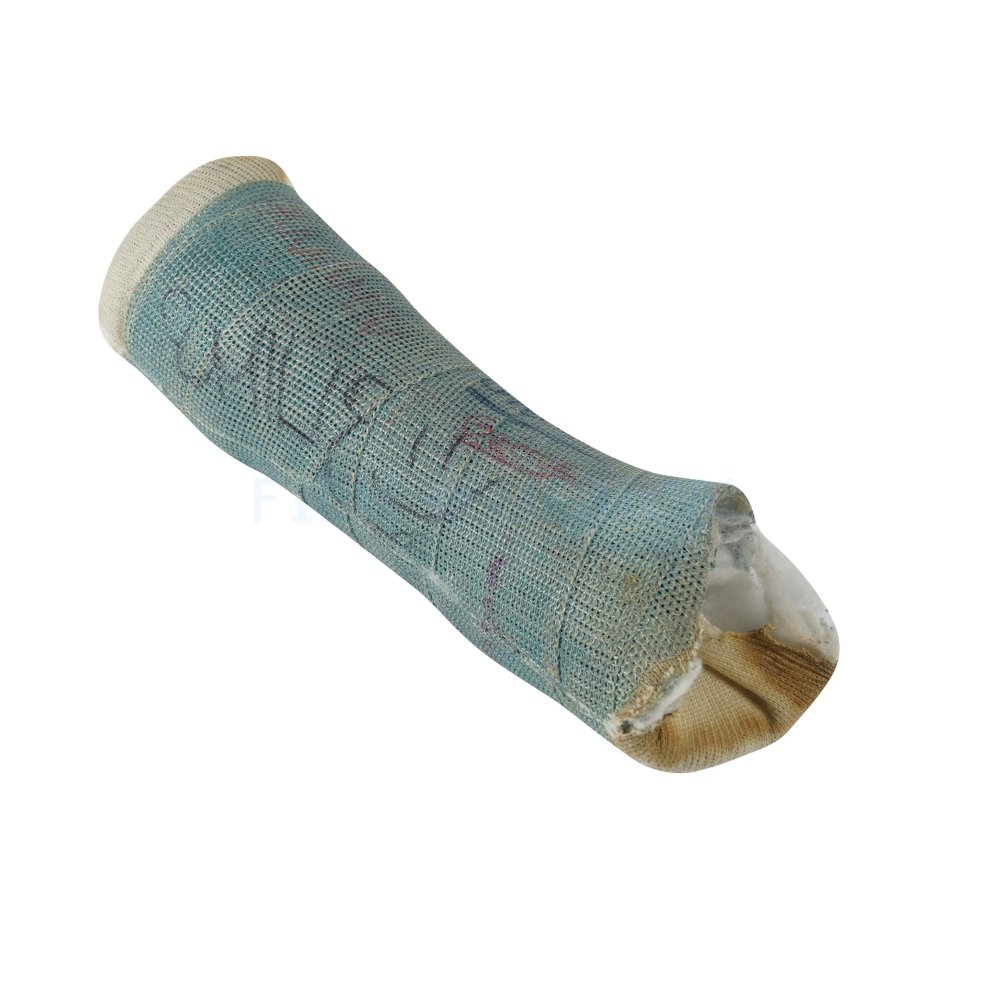 Cast Childs Arm | FILM MEDICAL