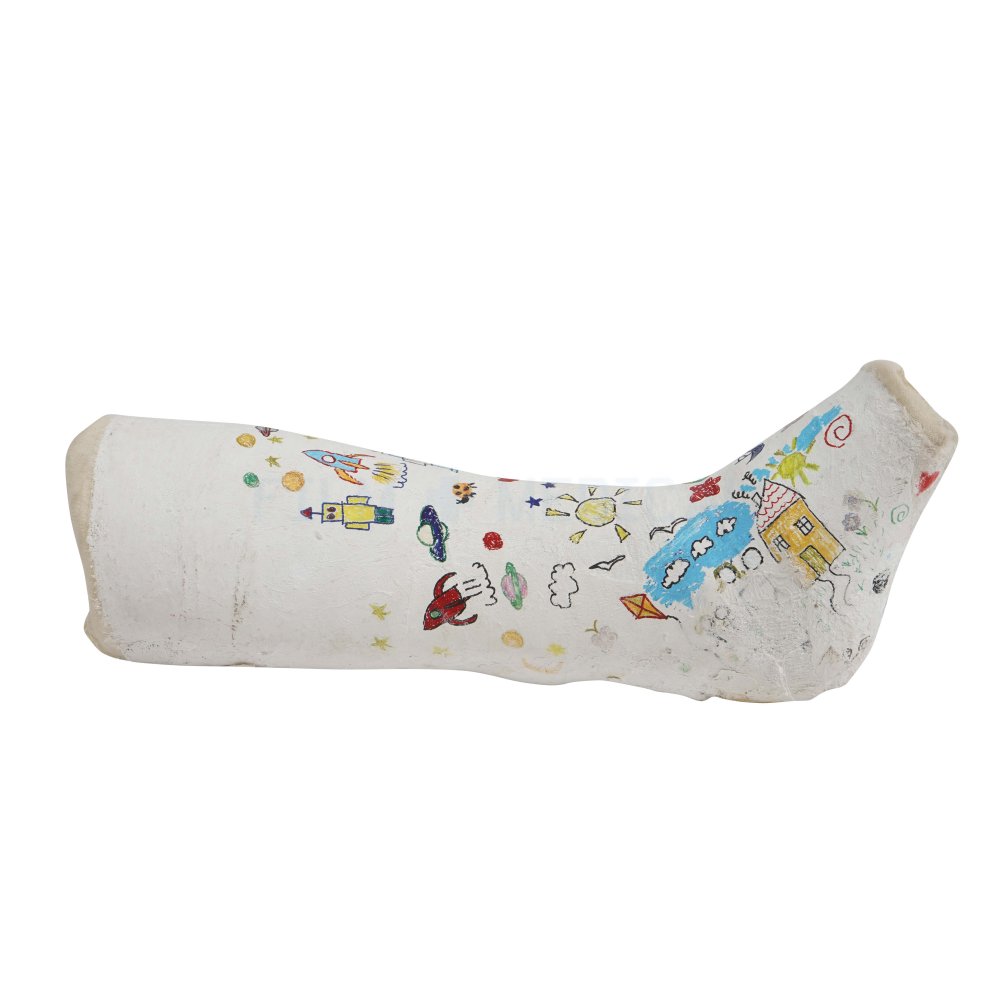 Leg Cast | FILM MEDICAL