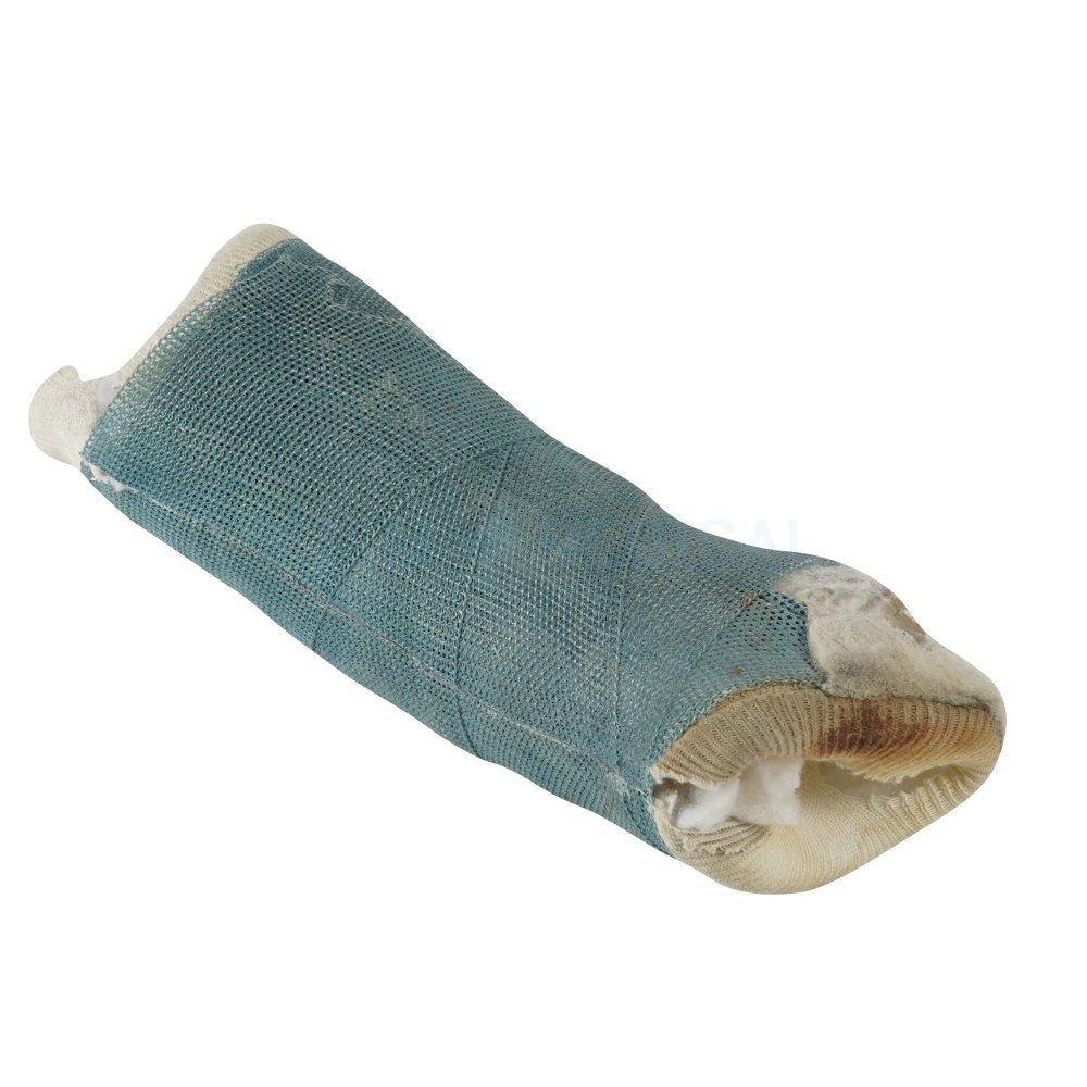 Half Arm Cast | FILM MEDICAL