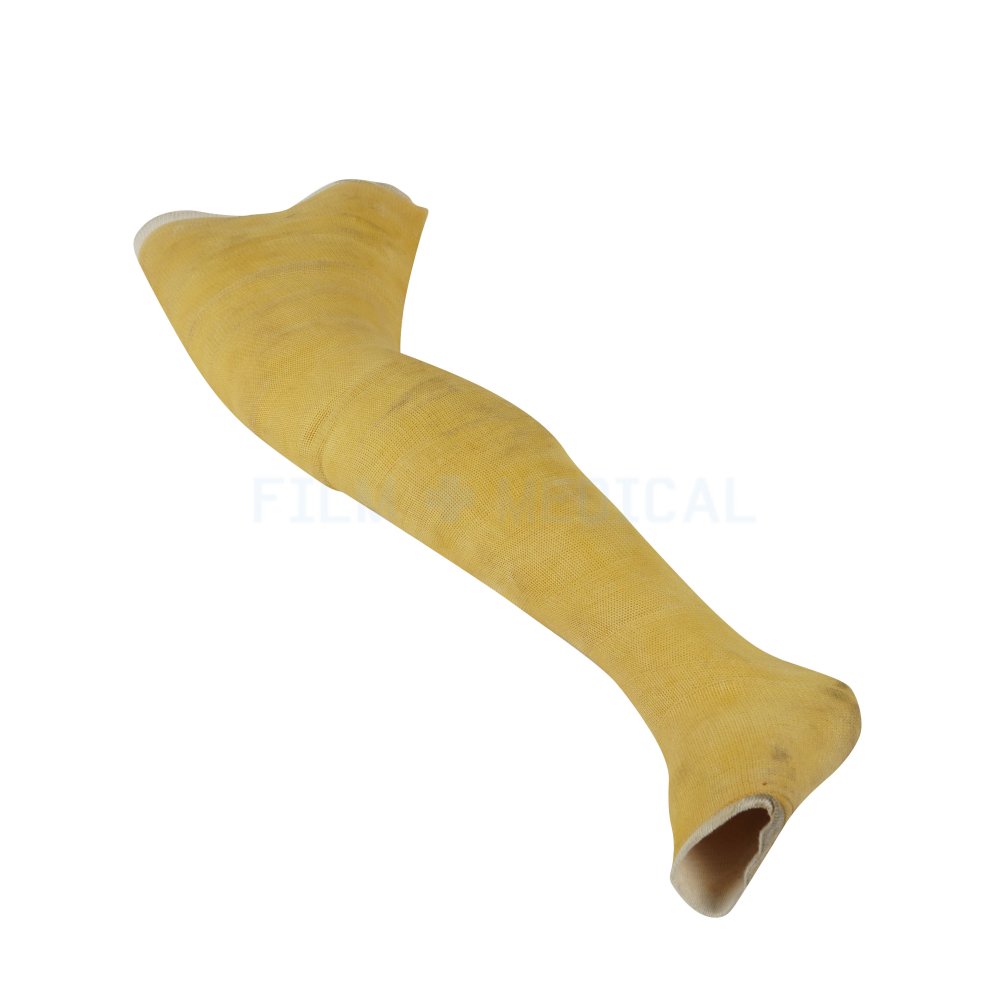 Full Leg Cast Yellow | FILM MEDICAL