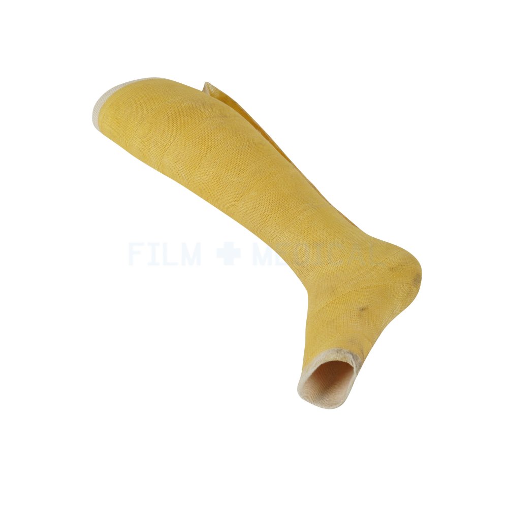 Leg Cast | FILM MEDICAL
