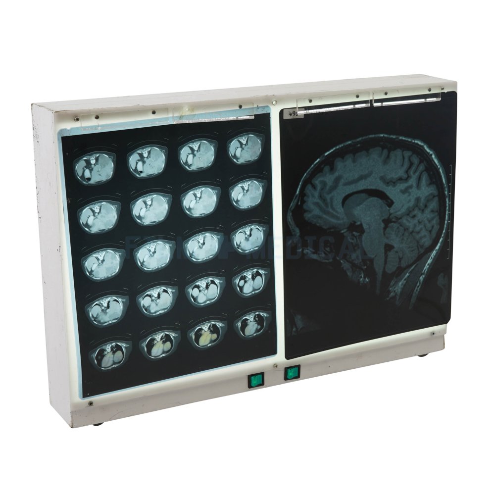 Double Light Box (X-Rays Priced Separately) | FILM MEDICAL