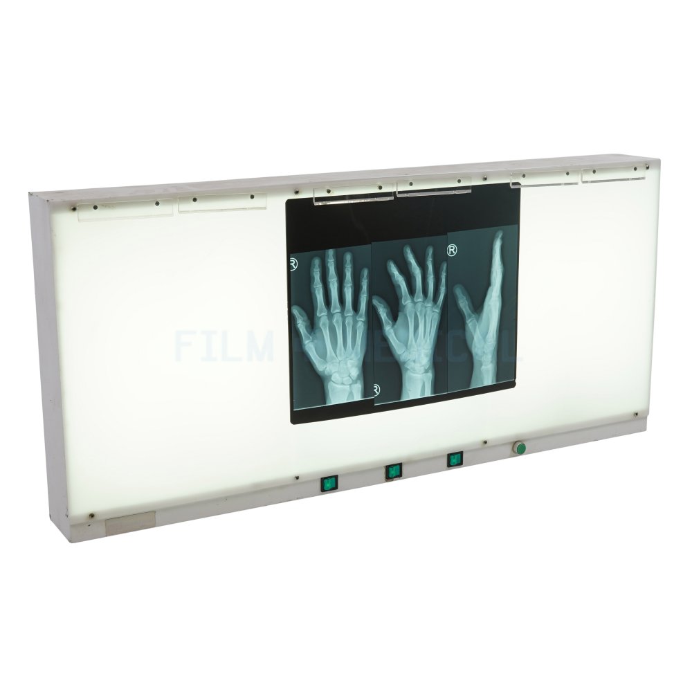 Triple Light Box (X-Rays Priced Separately) | FILM MEDICAL