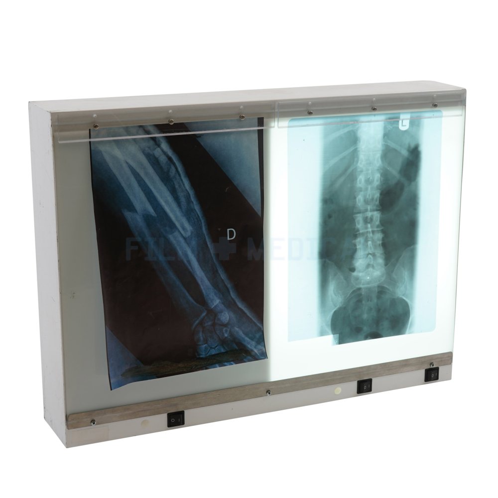 Double Light Box (X-Rays Priced Separately) | FILM MEDICAL