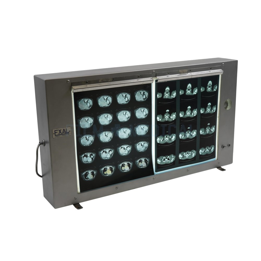 Period Double Light Box (X-Rays Priced Separately) | FILM MEDICAL