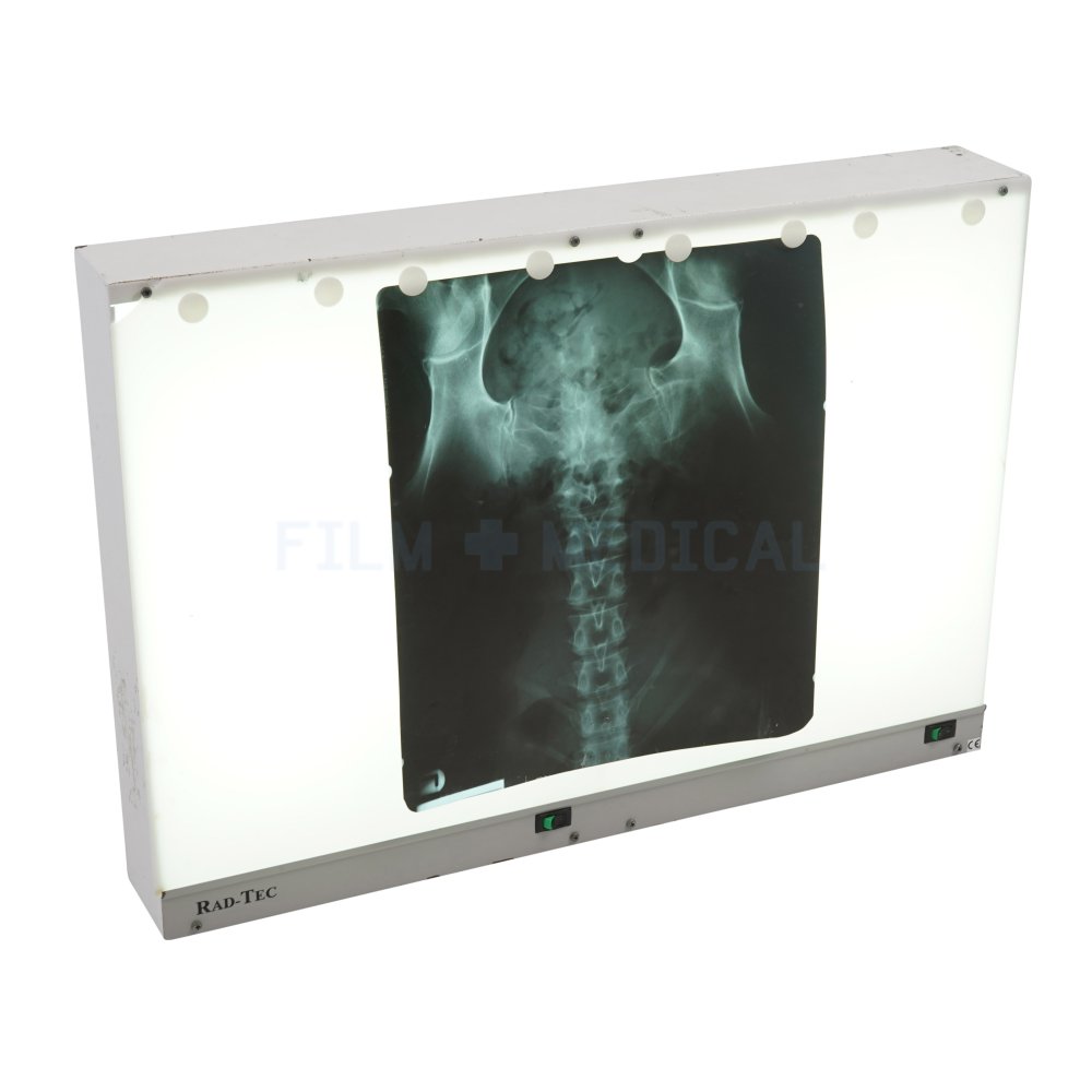 Double Light Box (X-Rays Priced Separately) | FILM MEDICAL