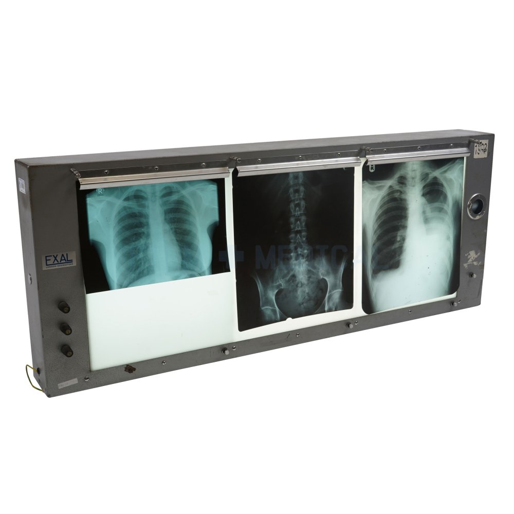 Triple Light Box (X-Rays Priced Separately) | FILM MEDICAL