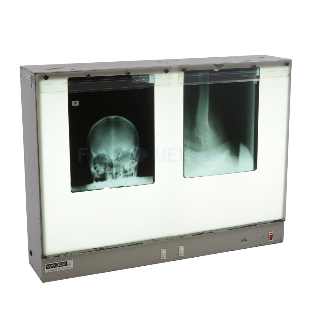 Double Light Box (X-Rays Priced Separately) | FILM MEDICAL