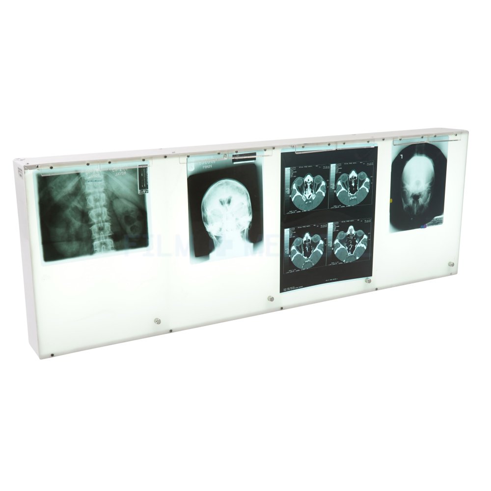 Quadruple Light Box (X-Rays Priced Separately) | FILM MEDICAL