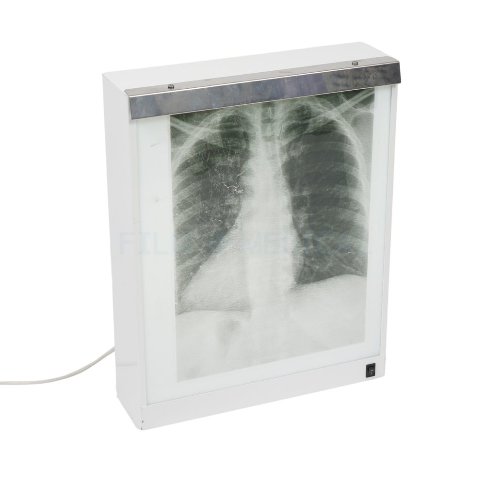Modern Single Lightbox | FILM MEDICAL