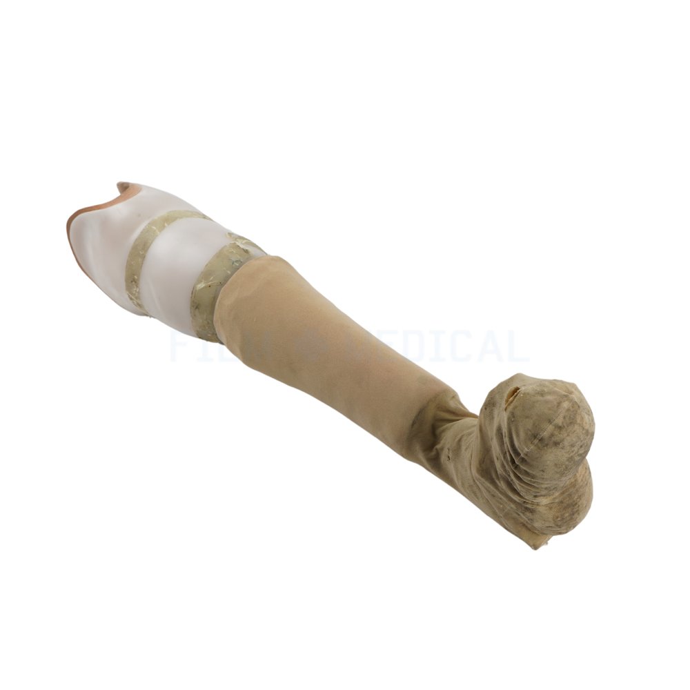 Prosthetic Leg | FILM MEDICAL