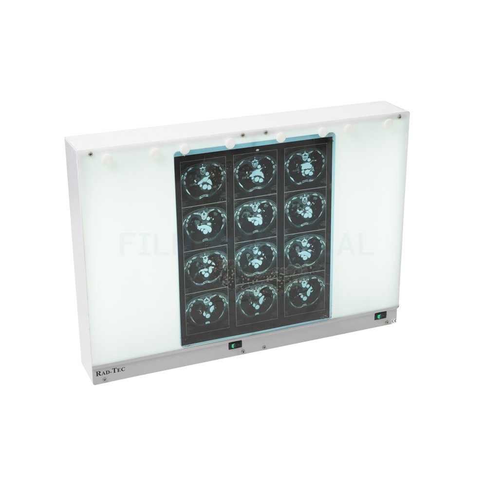 Rad-Tec X-Ray Double Lightbox | FILM MEDICAL