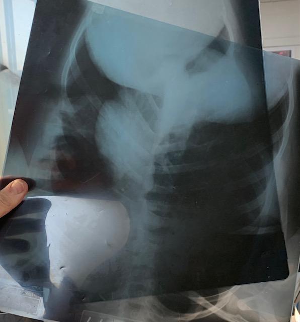 X Rays Assorted | FILM MEDICAL