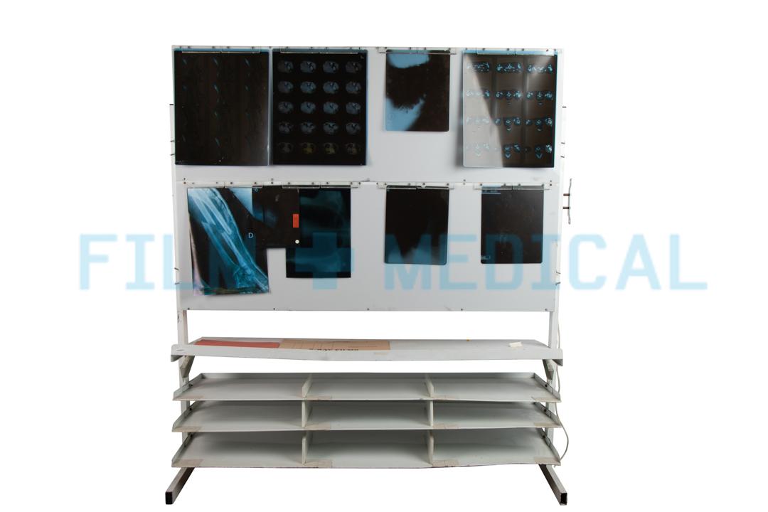 X Ray Lightbox Large ( X rays priced separately) | FILM MEDICAL