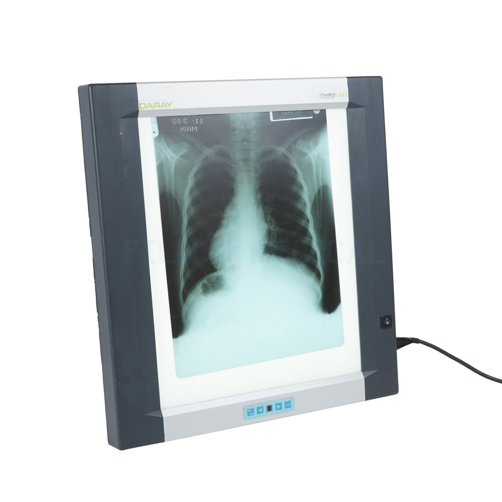 X-Ray Light Box Viewer | FILM MEDICAL
