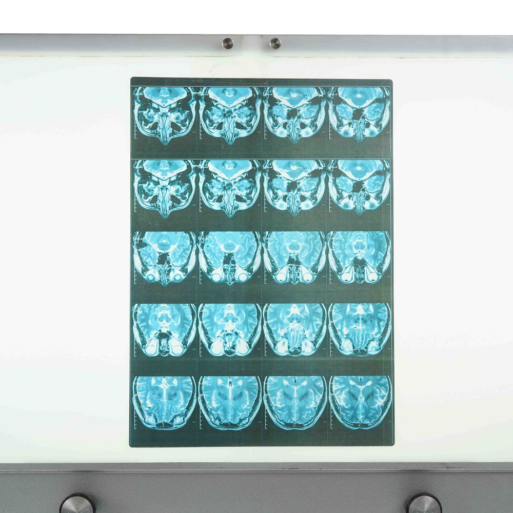 X -Ray CT Scan | FILM MEDICAL