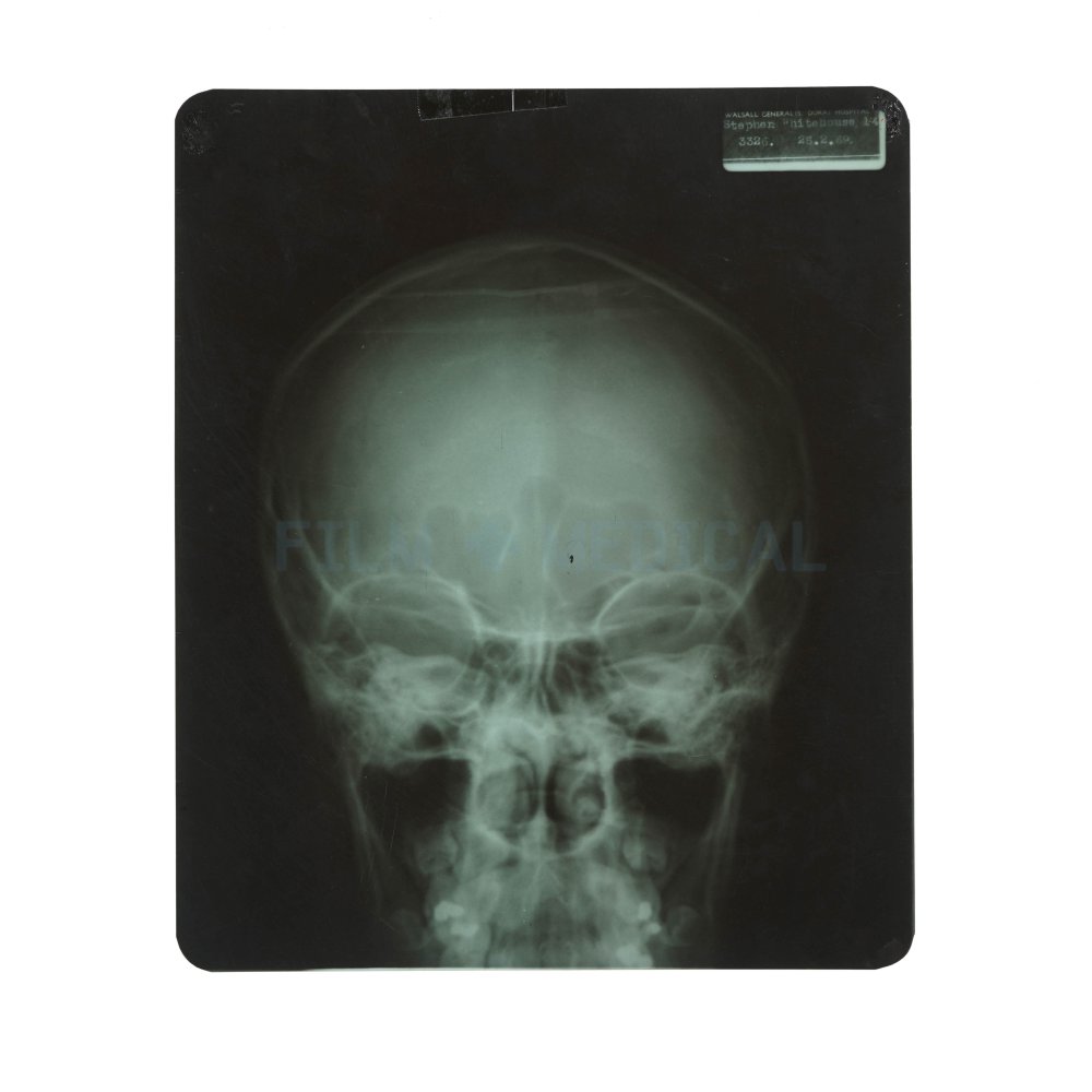 X_Ray Skull | FILM MEDICAL