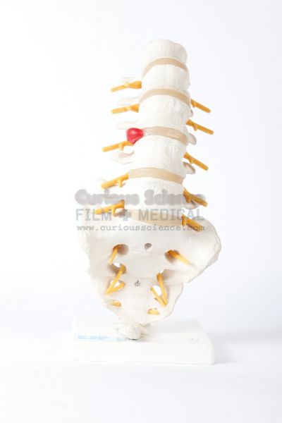 Lower Back Spinal model | FILM MEDICAL