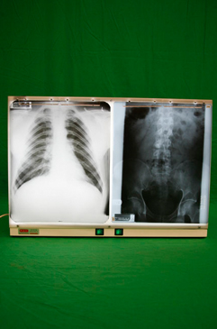 Double Light Box | FILM MEDICAL