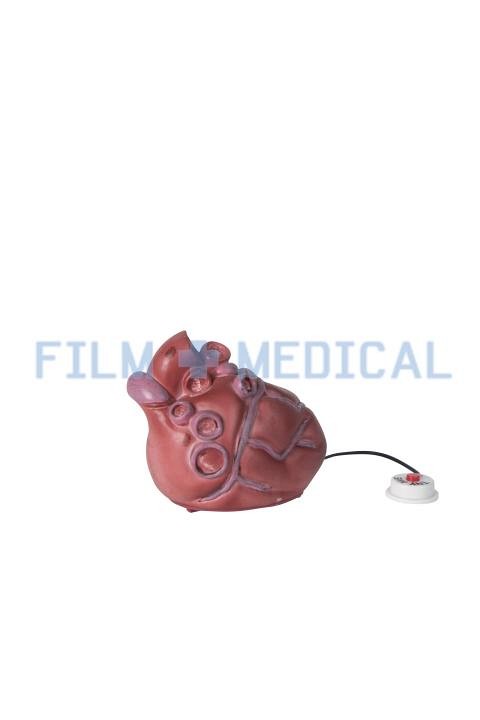 Beating Heart Model | FILM MEDICAL