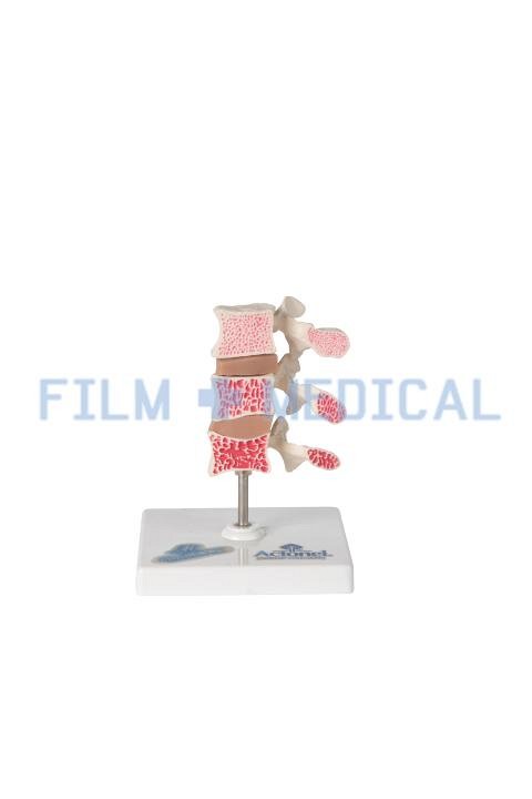 Anatomical Model of the Spine | FILM MEDICAL