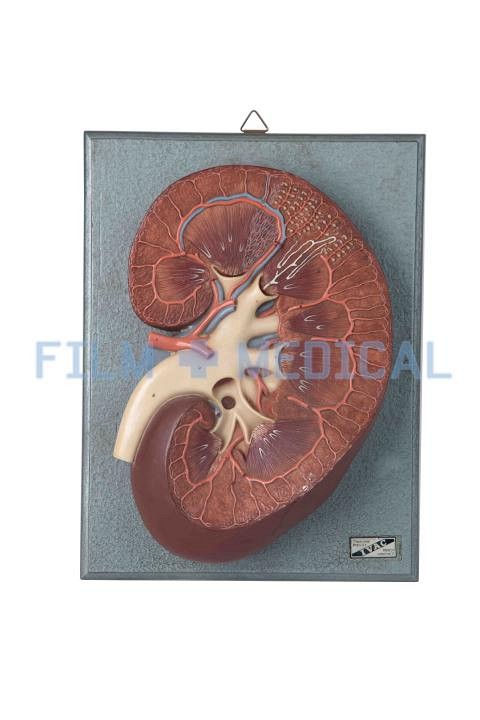 Kidney Model | FILM MEDICAL