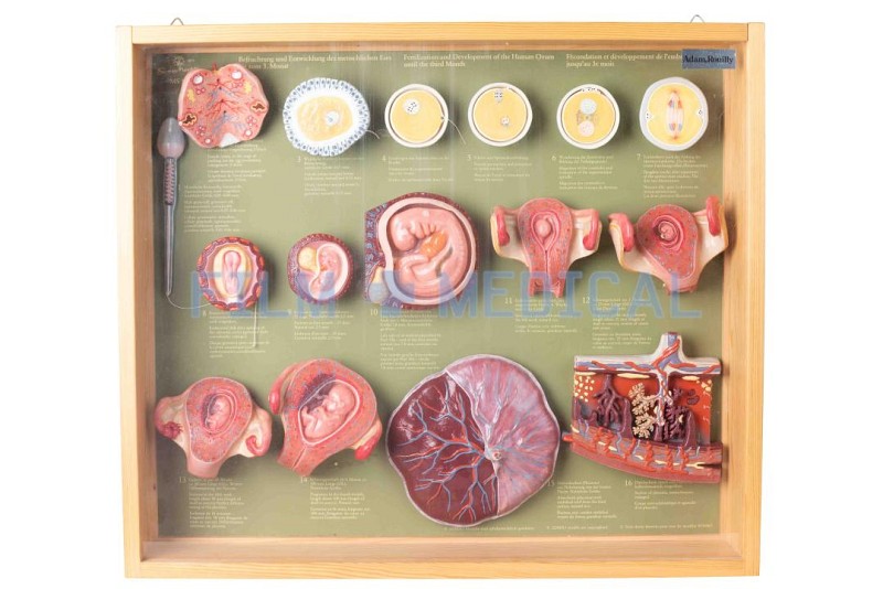 Framed Embryo Model | FILM MEDICAL