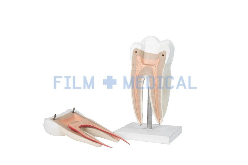 Tooth Model on Stand | FILM MEDICAL