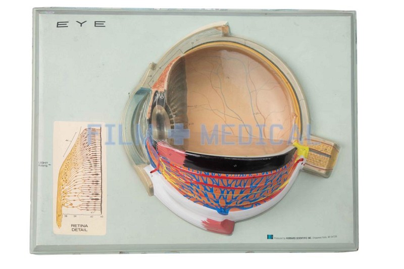 Sectional Eye Model | FILM MEDICAL