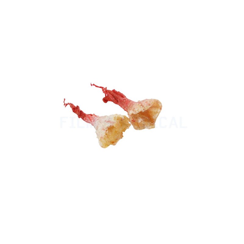 Fake Eye Sockets Priced Individually | FILM MEDICAL