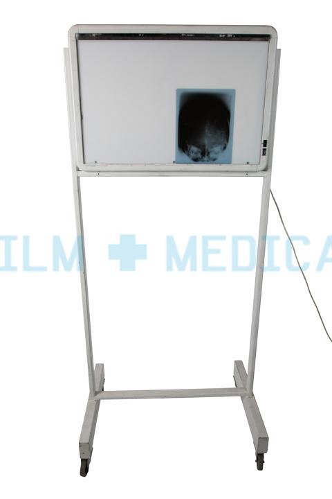 X Ray Lightbox Double Freestanding ( X Ray not Included) | FILM MEDICAL