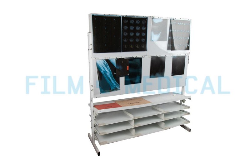 X Ray Lightbox Large ( X rays priced separately) | FILM MEDICAL