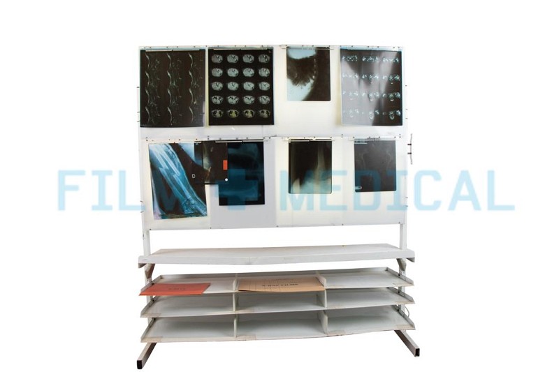 X Ray Lightbox Large ( X rays priced separately) | FILM MEDICAL