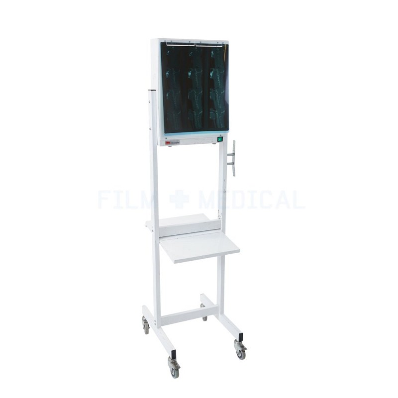Single Free Standing X-Ray Lightbox | FILM MEDICAL