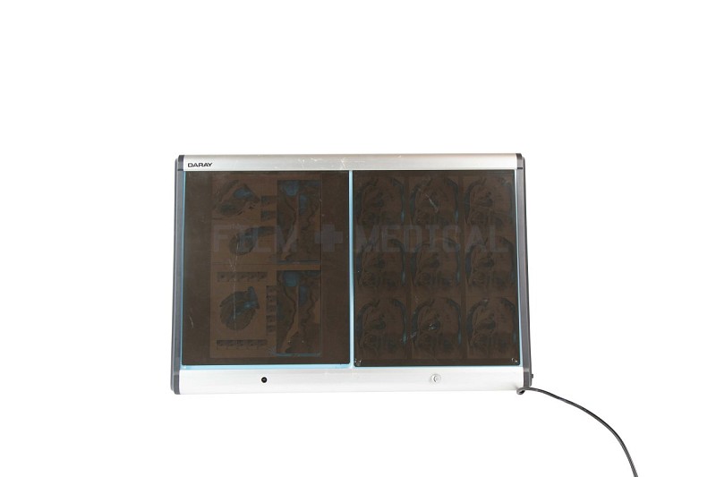 Double Wall Mount Light Box X- Rays priced Separately | FILM MEDICAL
