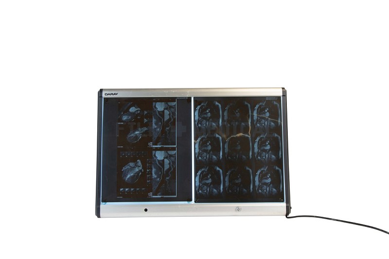 Double Wall Mount Light Box X- Rays priced Separately | FILM MEDICAL